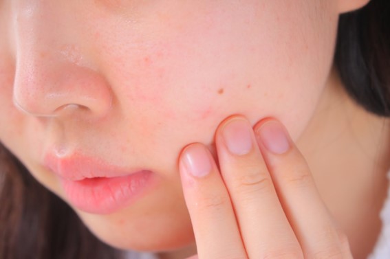 なぜか急増中！実は身近な皮膚がんについて 美容コラム はなふさ皮膚科・美容皮膚科 東京・埼玉・大阪・京都に12院展開